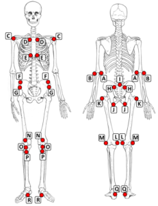 Enthesitis – Klinisk retningslinjer rygsøjlegigt